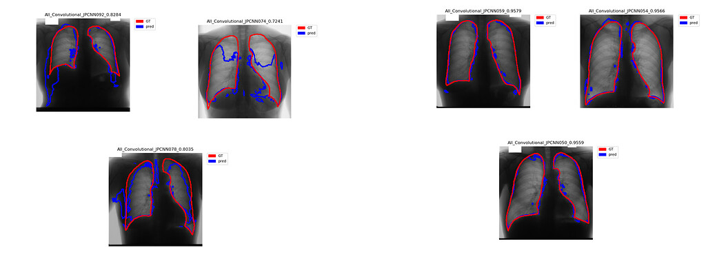 Img segmentation problem - vision - PyTorch Forums