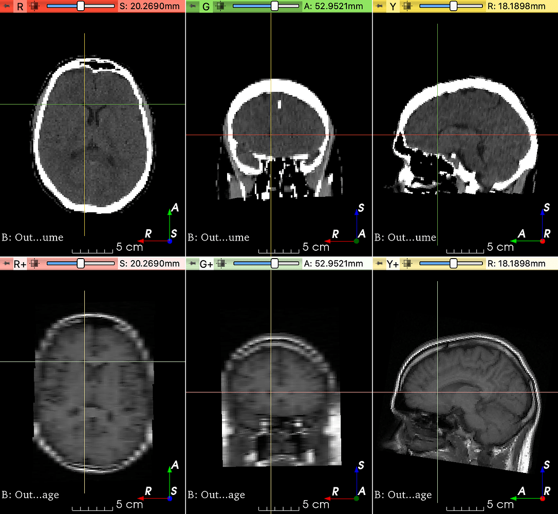 How to extract 2D patches from 3D medical image - vision - PyTorch Forums
