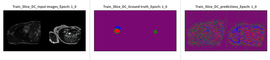 Calculate the loss and dice for multi-class segmentation - PyTorch Forums