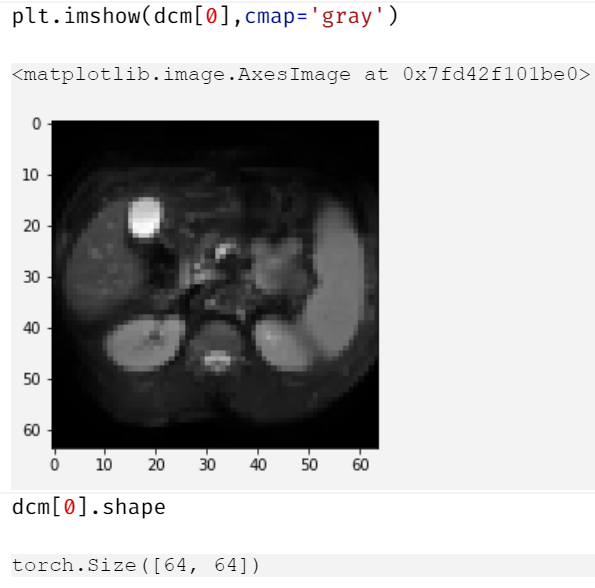 Tensorboard Image Quality Lower Than Matplotlib Vision Pytorch Forums