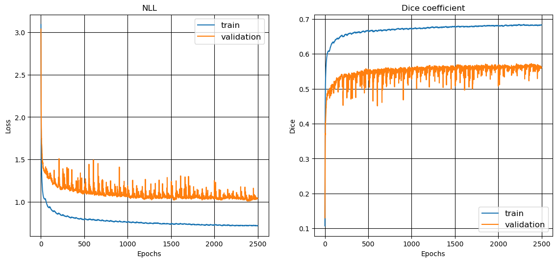 Difference between val loss and train loss - PyTorch Forums
